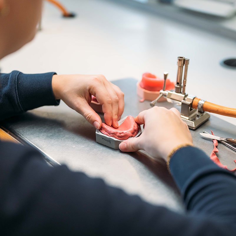 Frameprothese of gedeeltelijke prothese in onder- en/of bovenkaak.